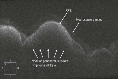Handbook of Retinal OCT: Optical Coherence Tomography