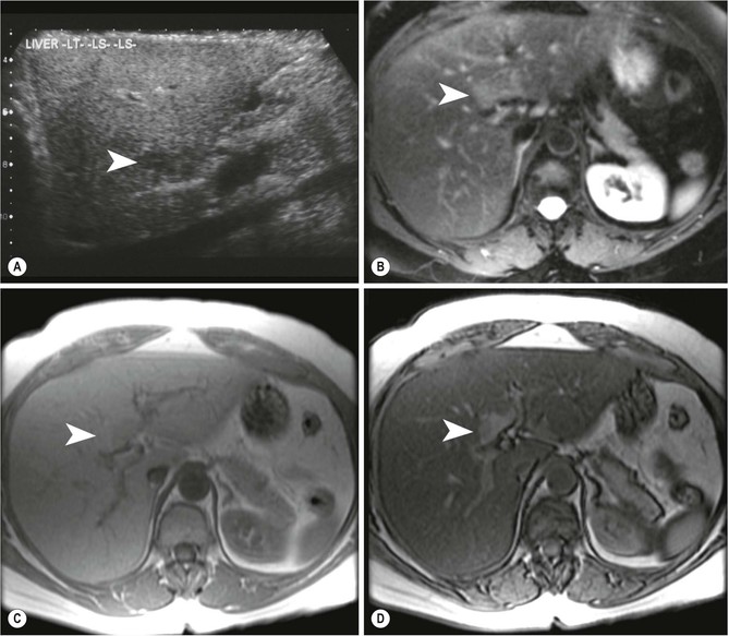 The Liver and Spleen