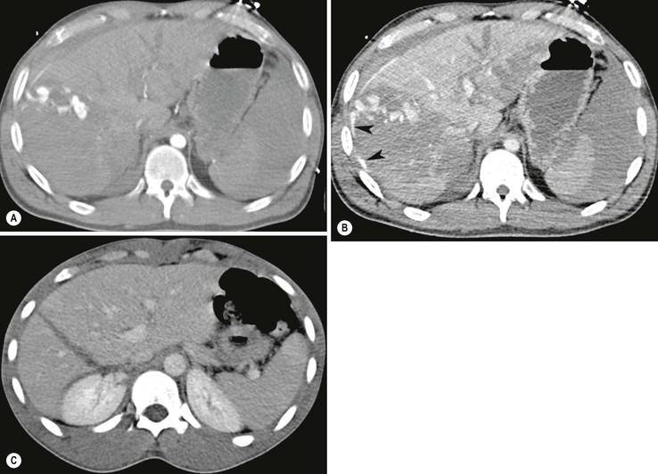 The Liver and Spleen