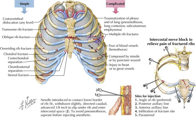 Netter's Clinical Anatomy