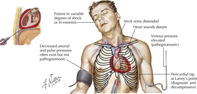 Netter's Clinical Anatomy