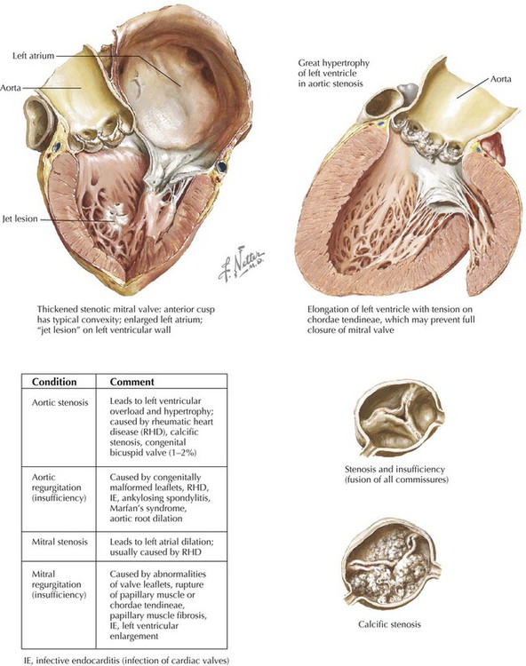Netter's Clinical Anatomy