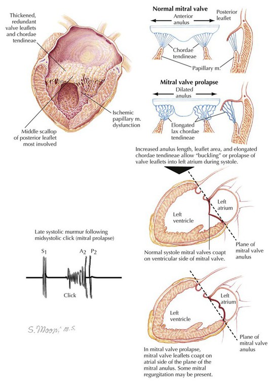 Netter's Clinical Anatomy