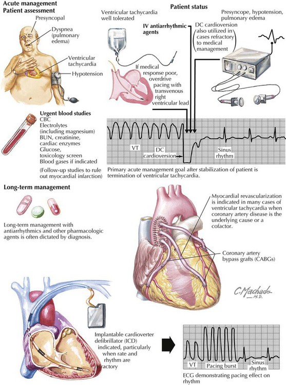 Netter's Clinical Anatomy