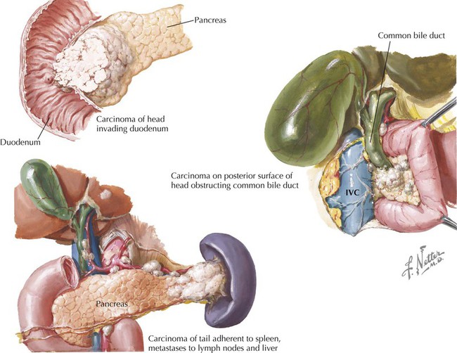 Netter's Clinical Anatomy
