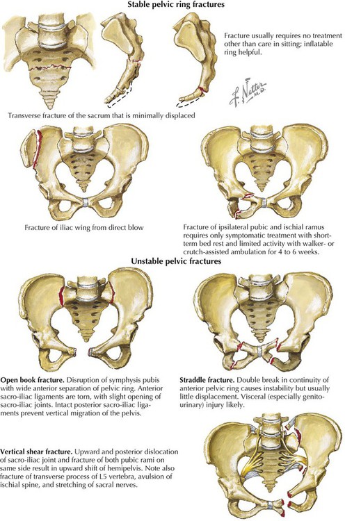 Netter's Clinical Anatomy