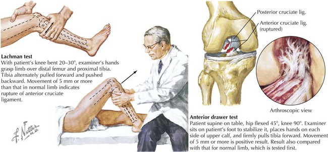 Netter's Clinical Anatomy