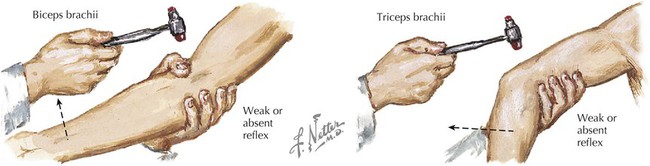 Netter's Clinical Anatomy