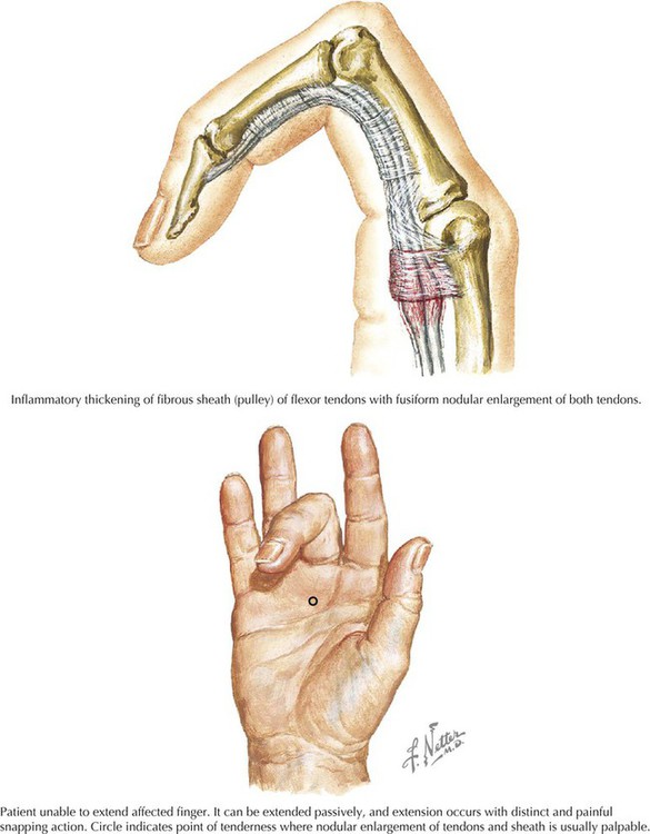 Netter's Clinical Anatomy