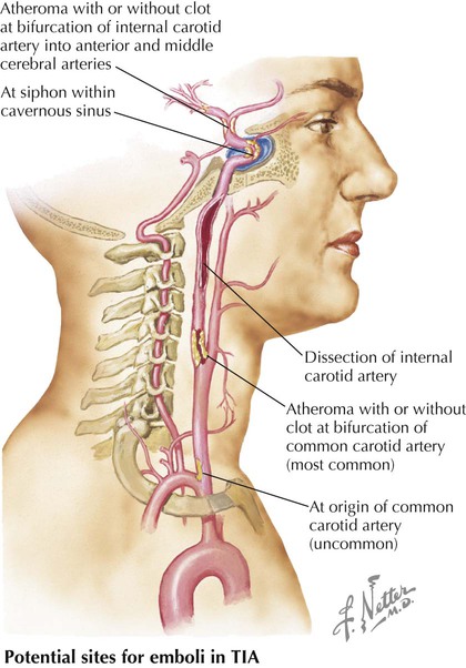 Netter's Clinical Anatomy