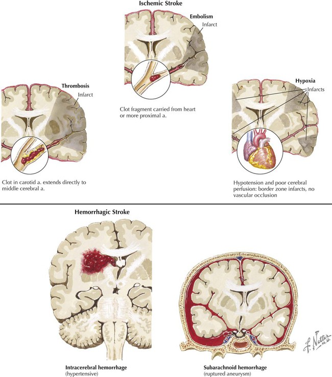 Netter's Clinical Anatomy