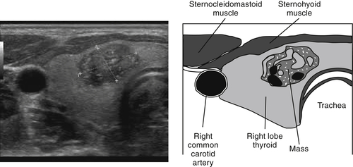 Sonography Scanning