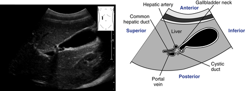 Sonography Scanning