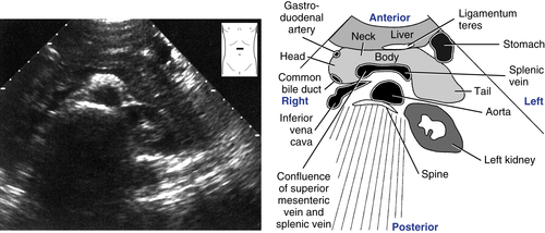 Sonography Scanning