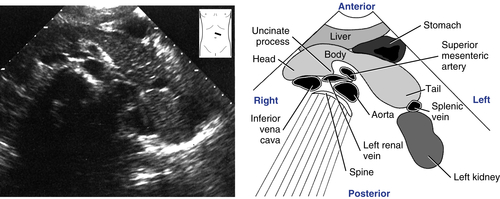 Sonography Scanning
