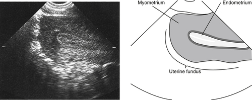 Sonography Scanning