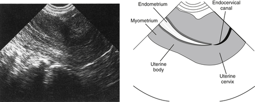 Sonography Scanning