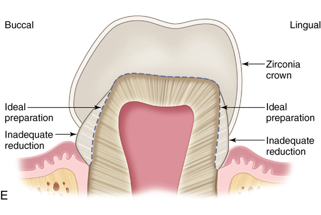Esthetic Dentistry