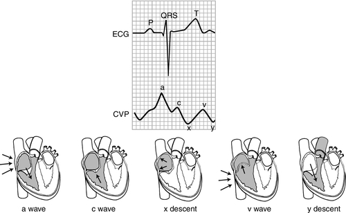 Hemodynamic Monitoring