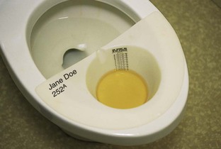 Specimen Collection and Diagnostic Testing