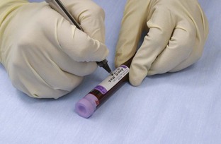 Specimen Collection and Diagnostic Testing
