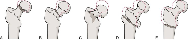 Health Promotion and Care of the Older Adult