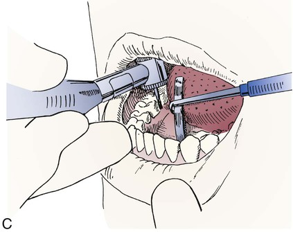Modern Dental Assisting