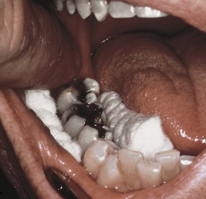 Modern Dental Assisting