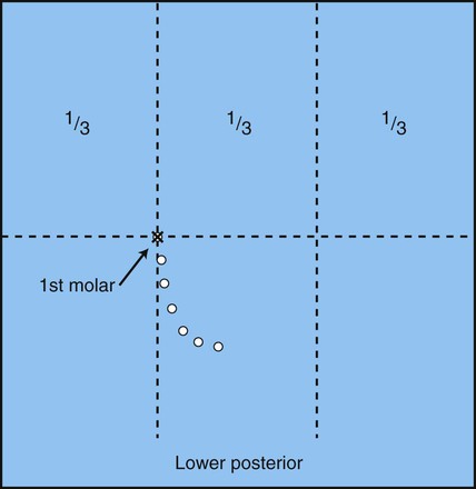 Modern Dental Assisting