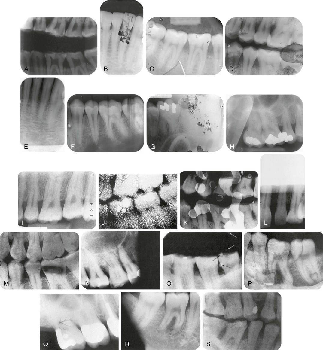 Modern Dental Assisting