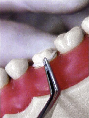 Modern Dental Assisting