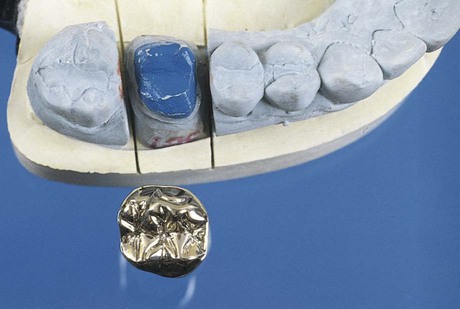 Modern Dental Assisting