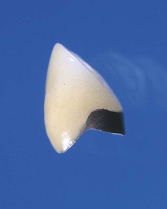 Modern Dental Assisting