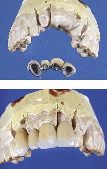 Modern Dental Assisting