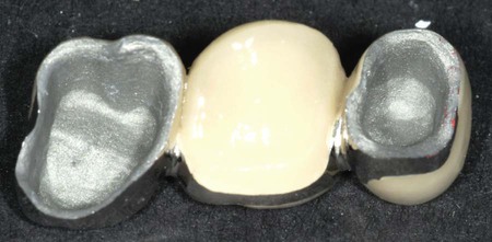 Modern Dental Assisting