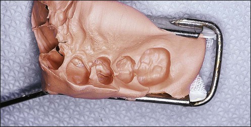 Modern Dental Assisting