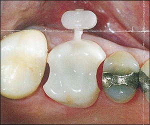 Modern Dental Assisting