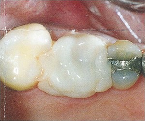 Modern Dental Assisting