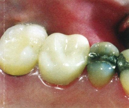 Modern Dental Assisting