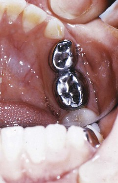 Modern Dental Assisting