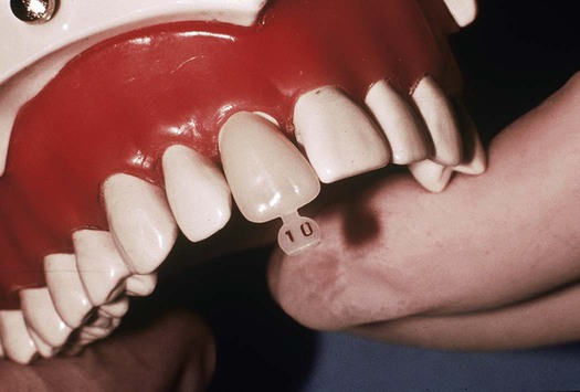 Modern Dental Assisting