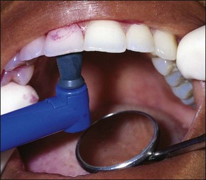 Modern Dental Assisting