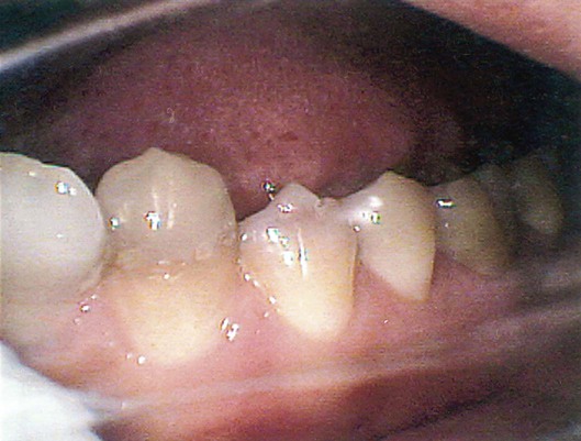 Modern Dental Assisting