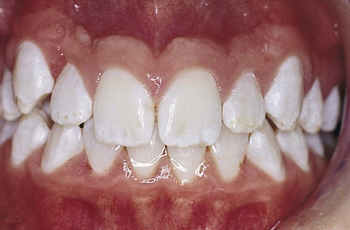 Modern Dental Assisting