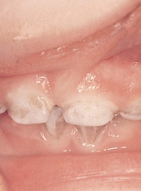 Modern Dental Assisting