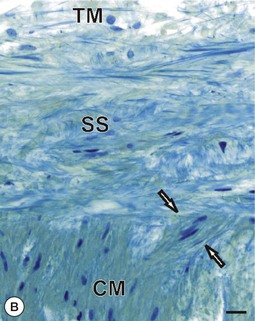 Functional Morphology of the Trabecular Meshwork Outflow Pathways