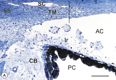Functional Morphology of the Trabecular Meshwork Outflow Pathways