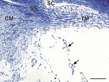 Functional Morphology of the Trabecular Meshwork Outflow Pathways