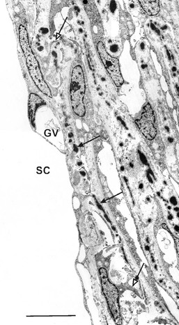 Functional Morphology of the Trabecular Meshwork Outflow Pathways