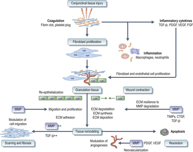 Tenon's Cyst Formation, Wound Healing, and Bleb Evaluation